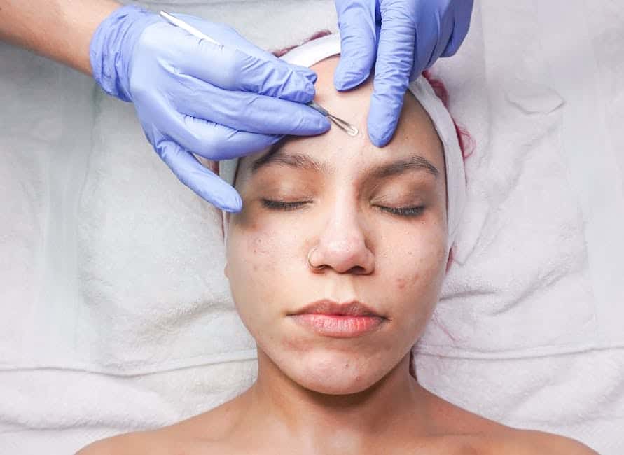 Pore Extraction Facial: Top 5 Secrets for Flawless Skin