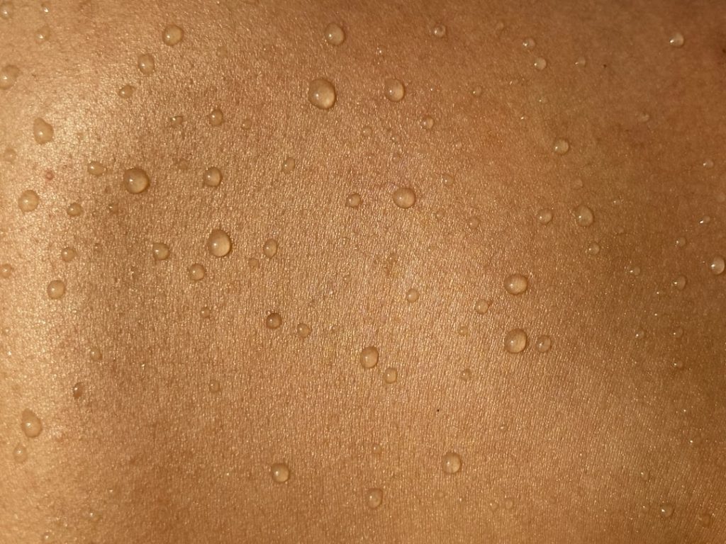Chemical Peels for Back Acne: 7 Powerful Ways to Clear Skin